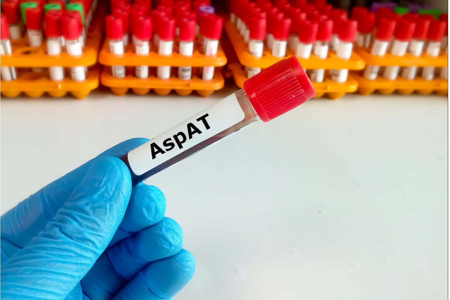 Aminotransferaza asparaginianowa (AspAT) — jakie są wskazania do ...