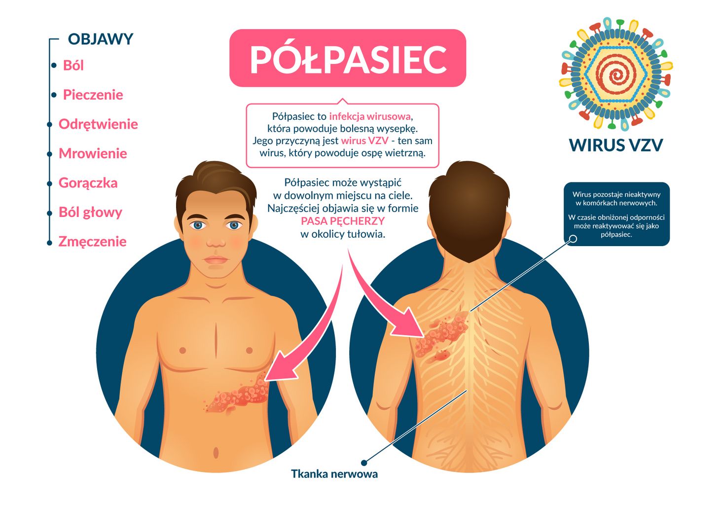 Półpasiec – objawy, leczenie. Jak boli półpasiec, czy jest zaraźliwy?